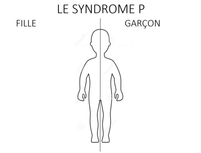 Le syndrome P